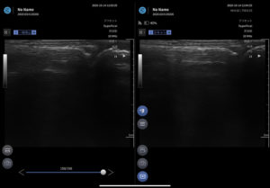 「超音波画像診断装置 SONON」iOS用 新アプリケーション公開のお知らせ | 酒井医療株式会社
