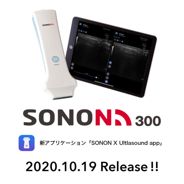「超音波画像診断装置 SONON」iOS用 新アプリケーション公開のお知らせ | 酒井医療株式会社